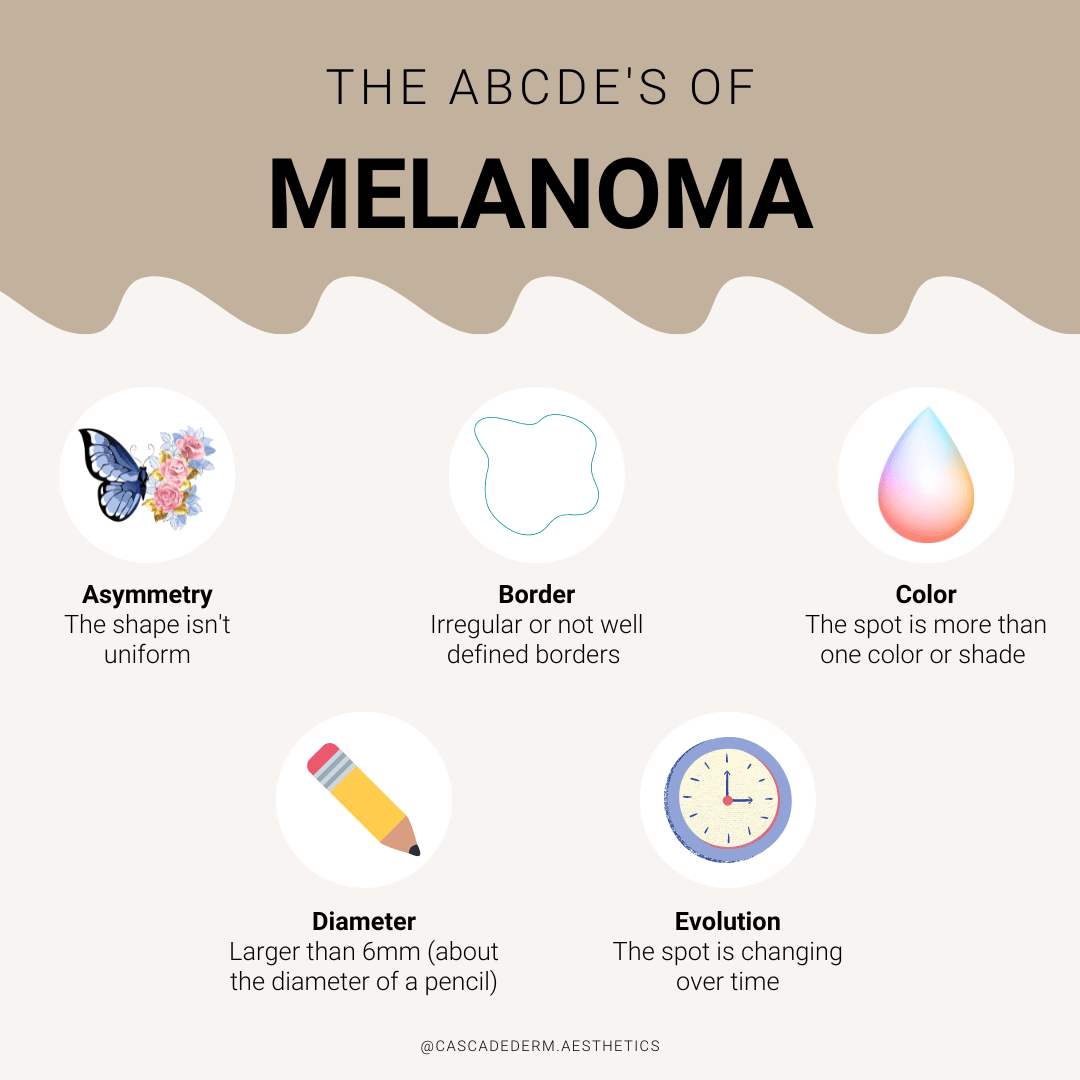 The ABCDEs of Melanoma