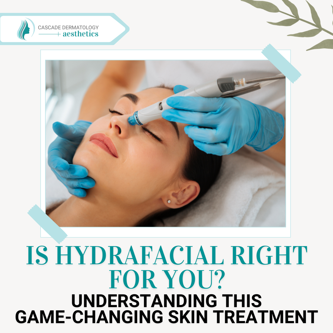 Is Hydrafacial Right for You? Understanding This Game-Changing Skin Treatment