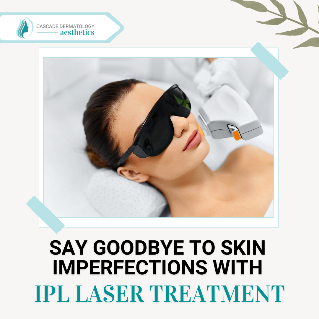 Say Goodbye to Skin Imperfections with IPL Laser Treatment